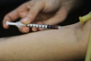 Track Marks on Arm: Causes, Dangers & How to Treat Them - Long Island ...