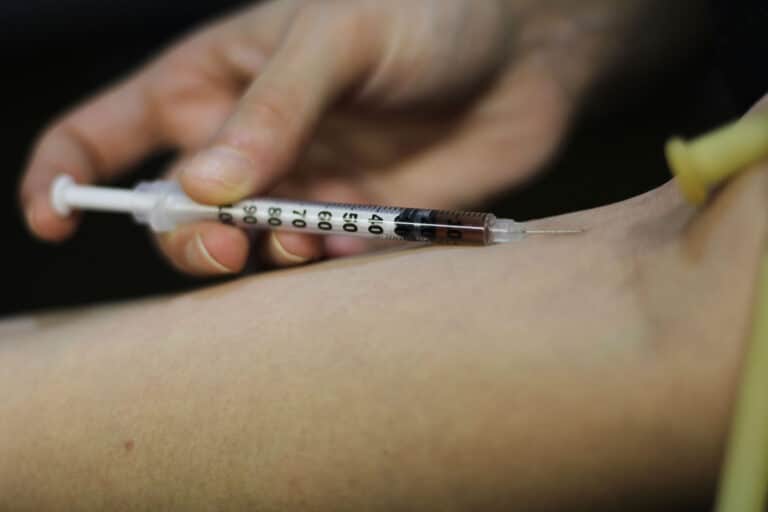 Track Marks on Arm: Causes, Dangers & How to Treat Them - Long Island ...